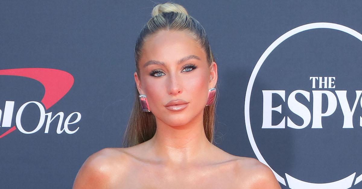 Alix Earle's Acne Journey: Influencer Opens Up About Her Struggles